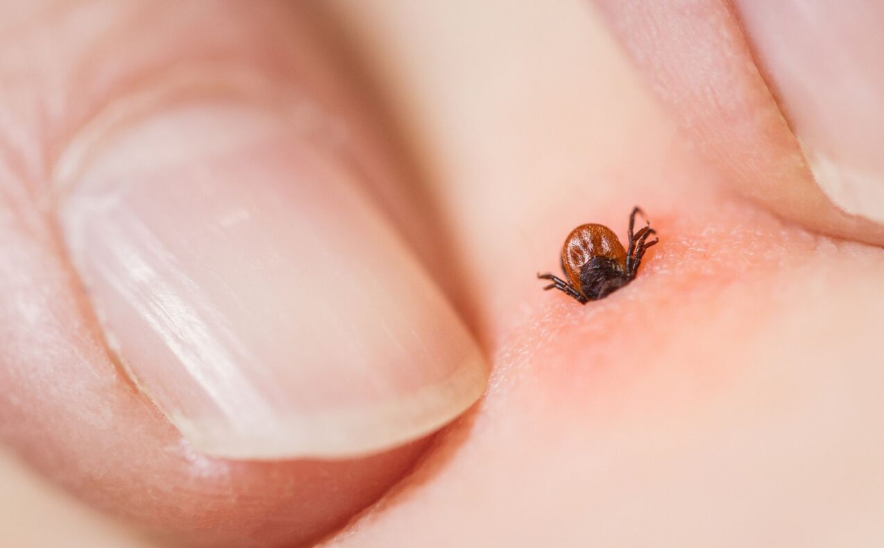 LA Post: Tick activity spikes on Los Angeles hiking trails - The Los ...